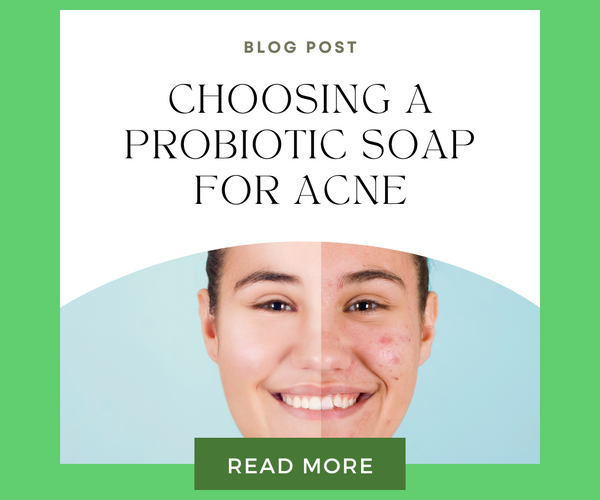 Choosing a Probiotic Soap for Acne: A Natural Solution